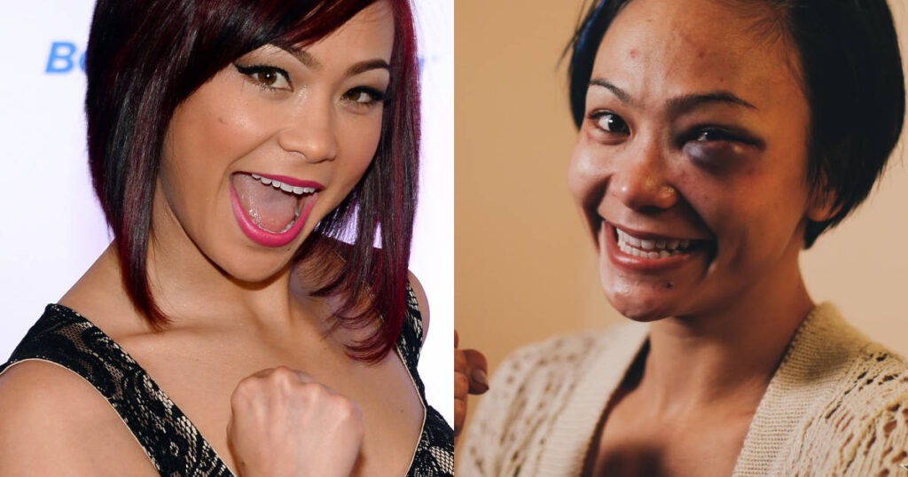 Five Photos Of The Hottest UFC Stars Before And After Fights