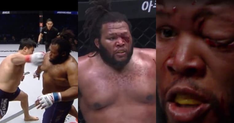 Meanwhile In Asian MMA-The Worst Eye Injury You'll Ever See